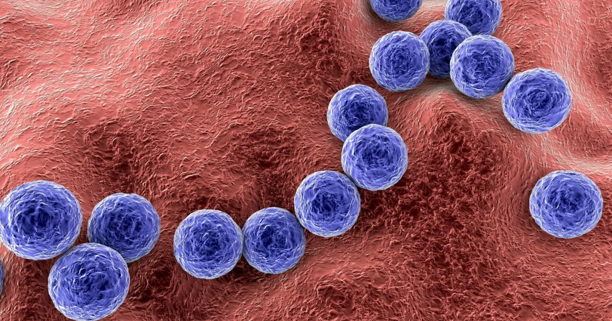 El brote de Streptococcus pyogenes causó 78 muertes en el país ...